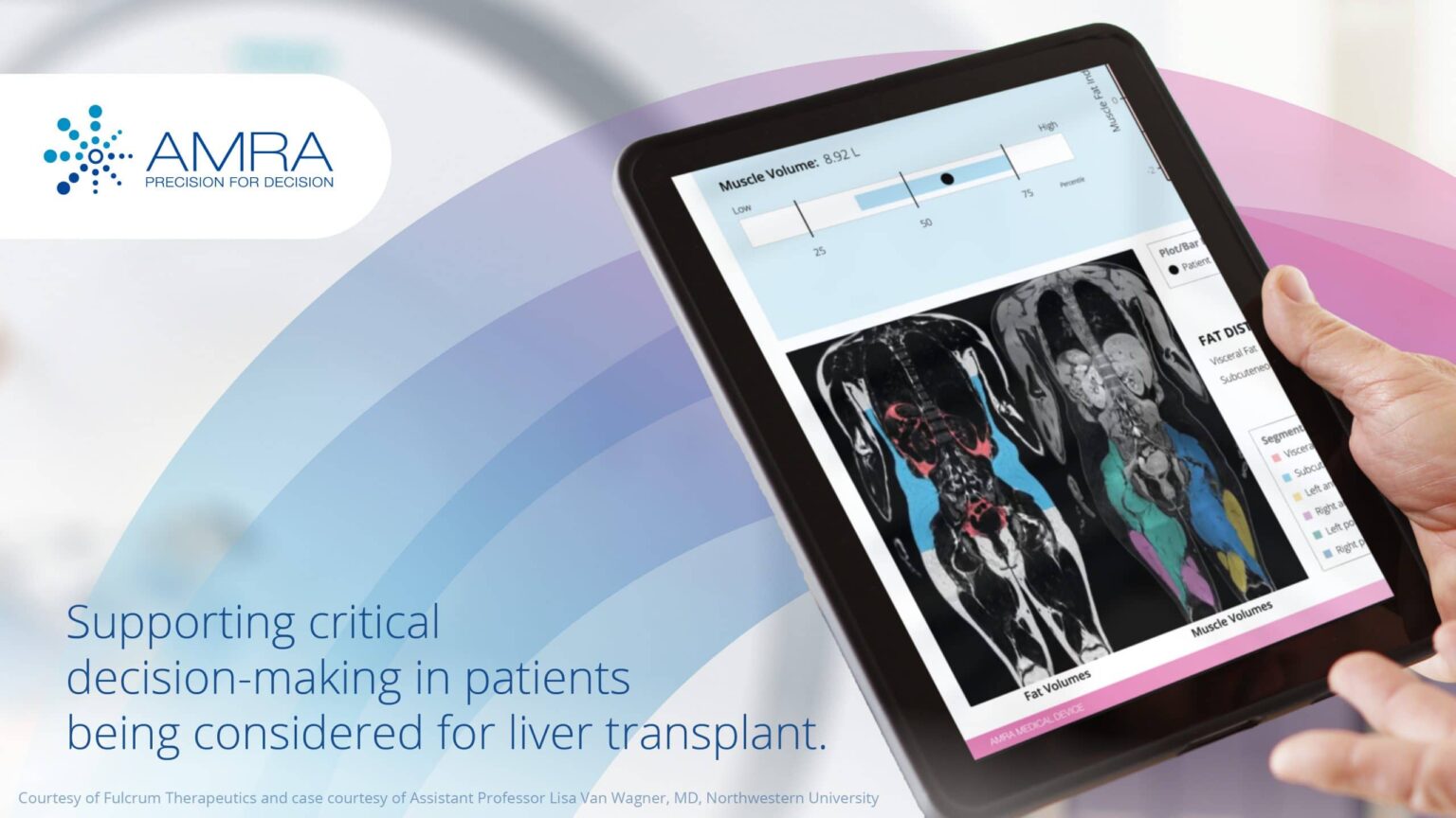 AMRA Medical Introduces Paradigm-shifting MRI Analysis Services at RSNA ...