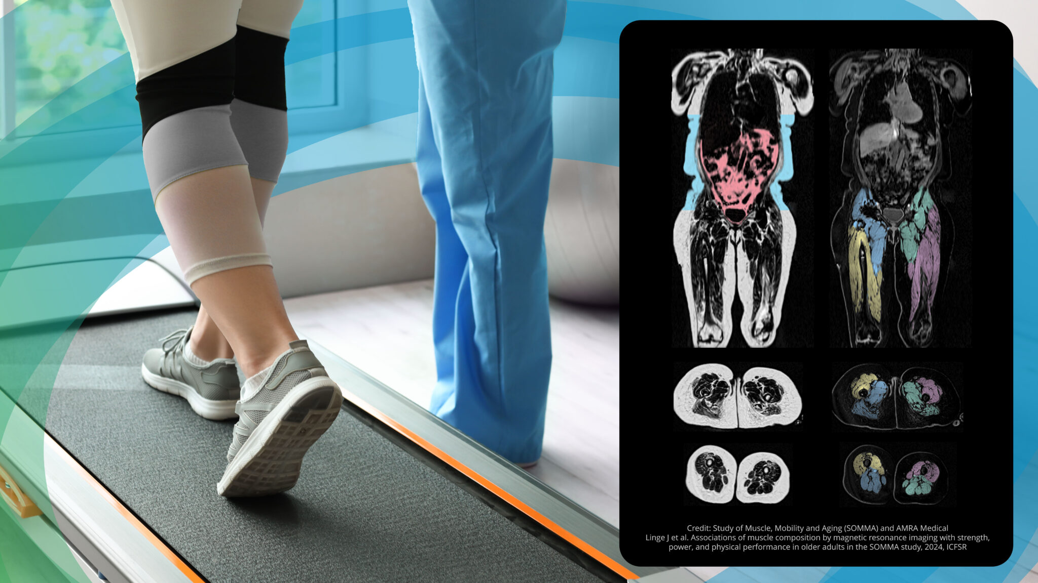 Latest AMRA Medical Findings Presented at ICFSR 2024 Link Muscle ...